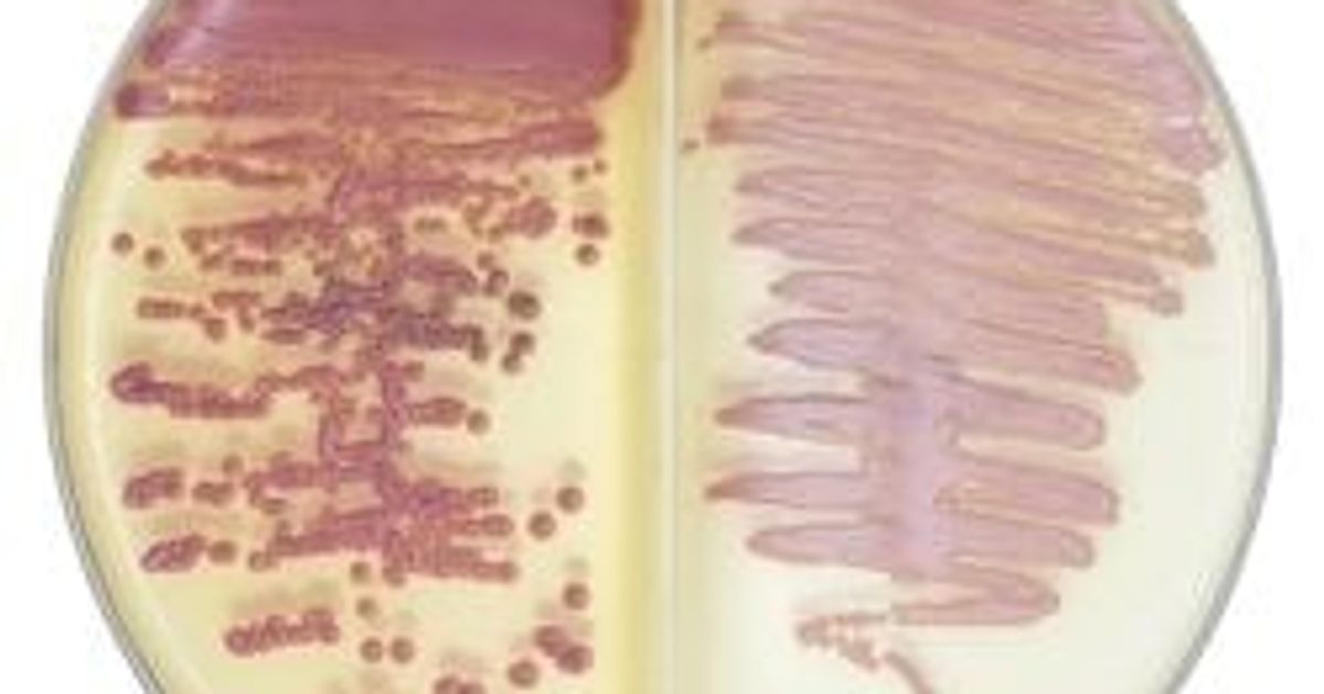 Bi-plate BD BBL™ CHROMagar™ MRSA II/CHROMagar™ Staph aureus reviews