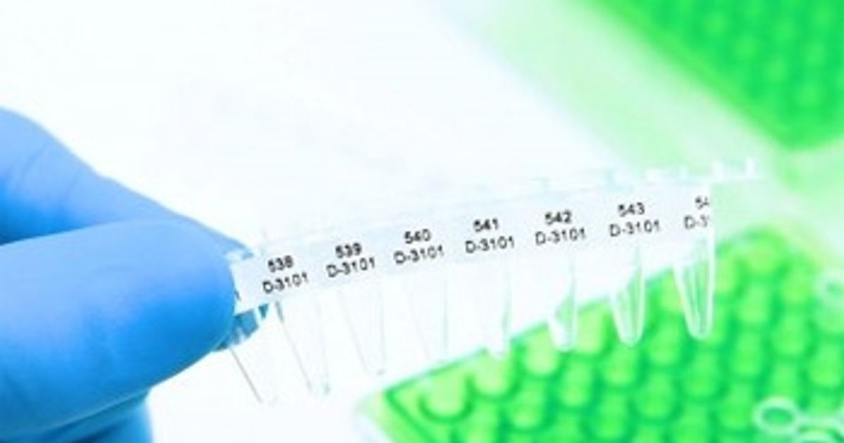 Label 8 PCR Tubes at Once With New Printable Sample Labels