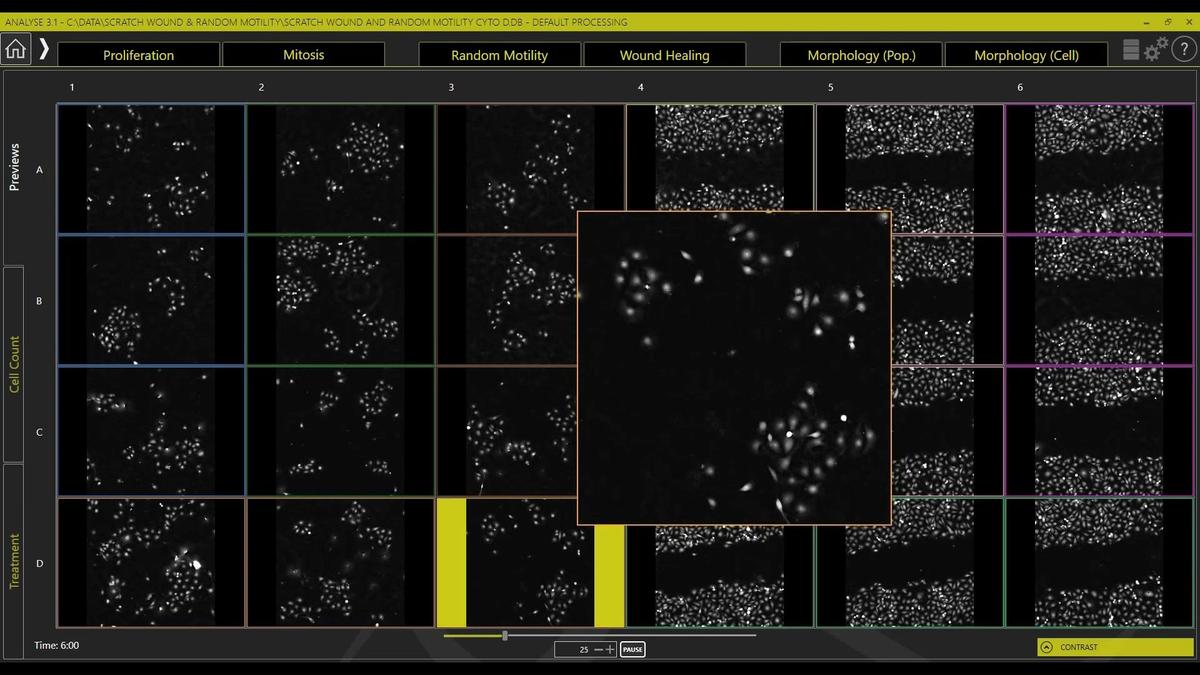 Livecyte® Cell Analysis System reviews