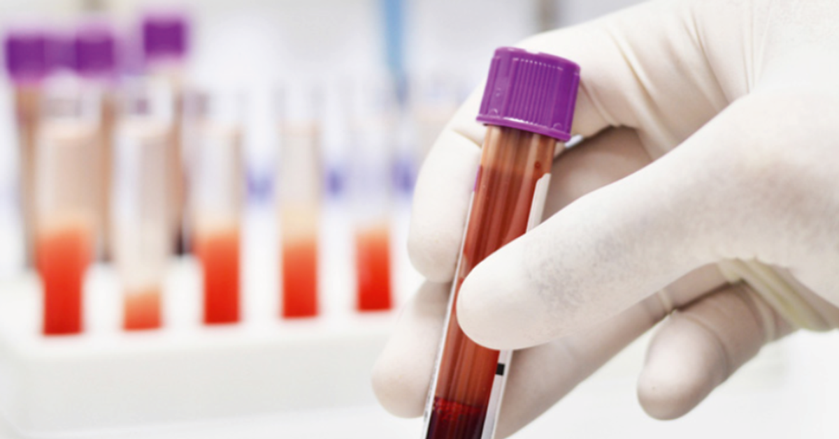 HLA typing using long-range PCR and next-generation sequencing