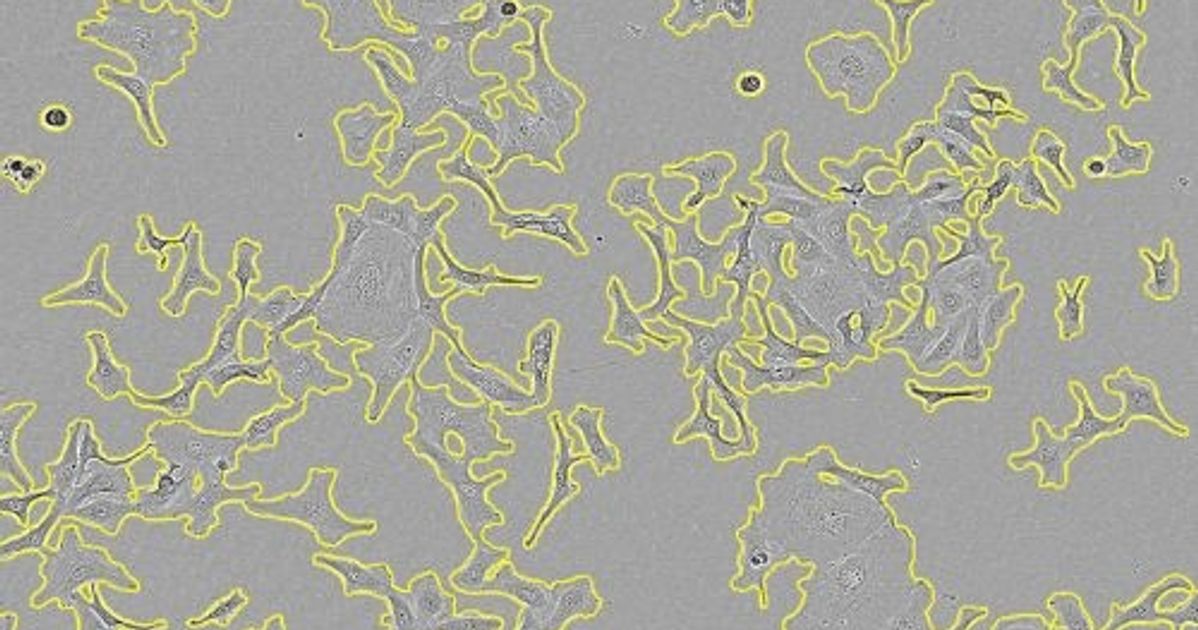Buy Incucyte® AI Confluence Analysis Read Reviews
