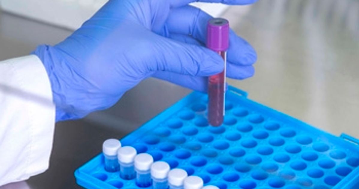 The importance of maintaining sample integrity throughout the COVID-19 ...