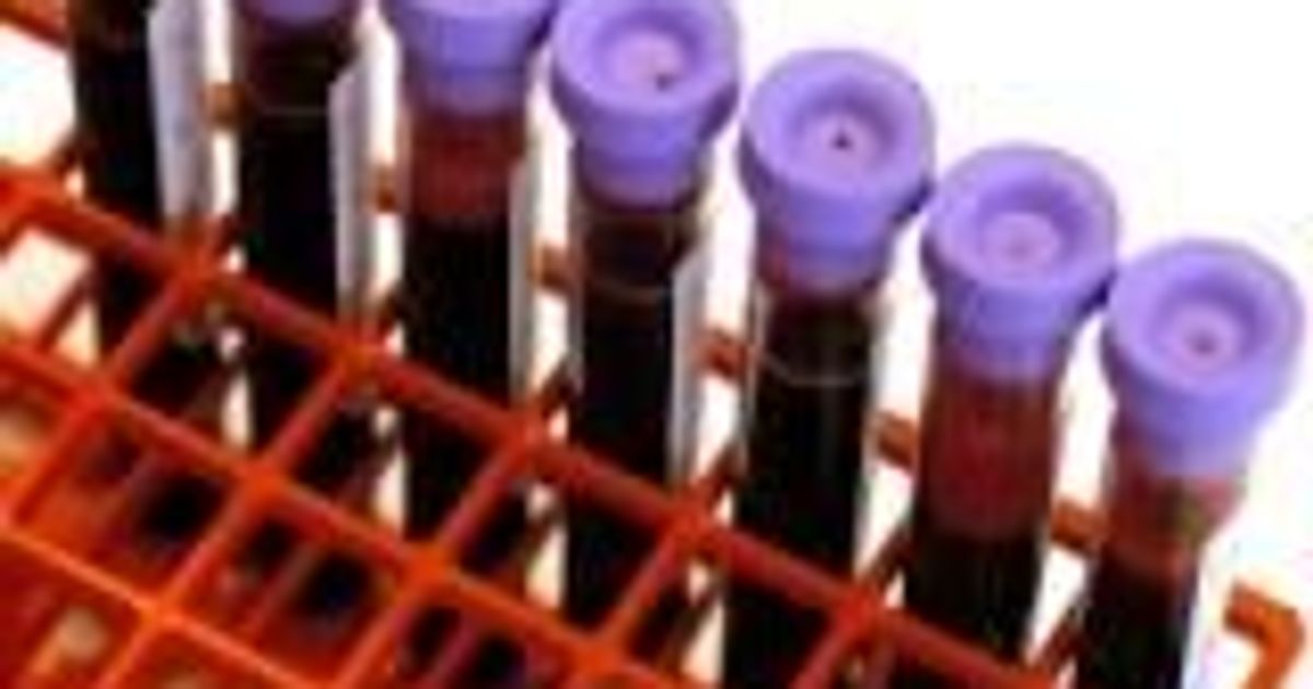 A powerful yet simple new methodology for a total nucleated cell ...