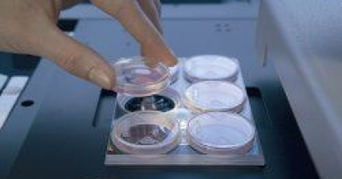 Cell Research Advances Promised with PALM MicroBeam System Enhancements