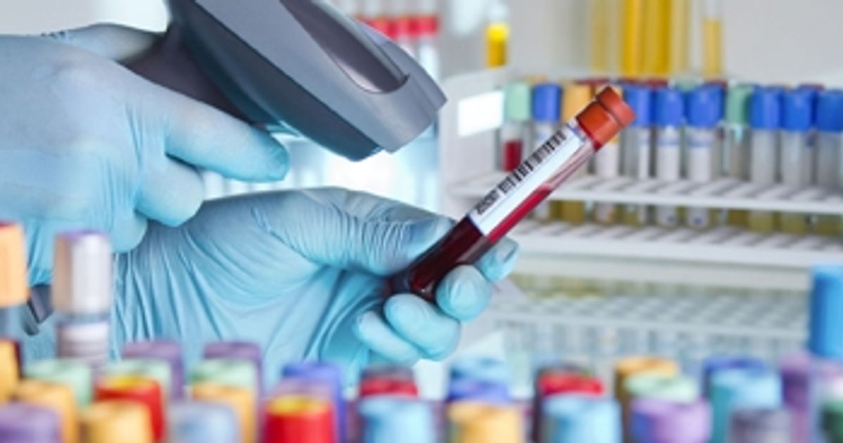 Webinar Highlights: How to Keep Your Sample Tracking Error-Free