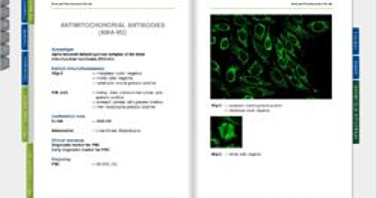 Online Immunofluorescence Guide for Autoimmune Disease Diagnosis