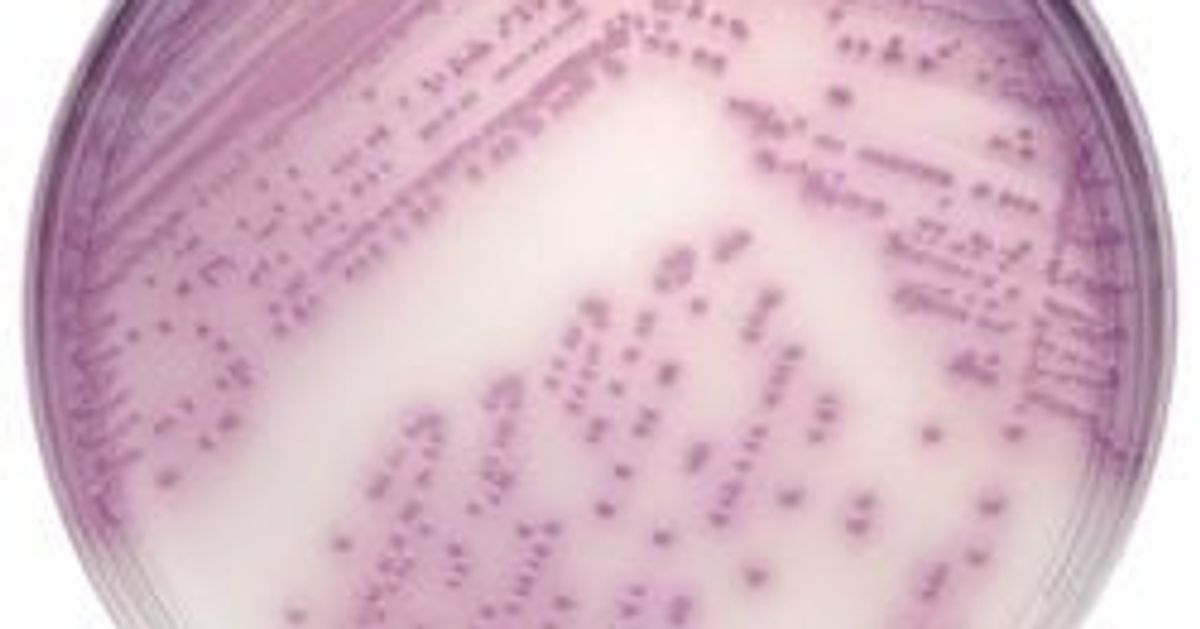 BD BBL™ CHROMagar™ Salmonella Plate reviews