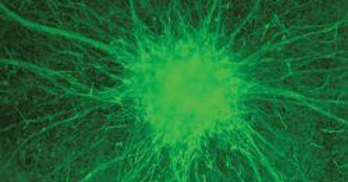 ReNcell ® VM Neural Stem Cell Line Models Parkinson’s Disease