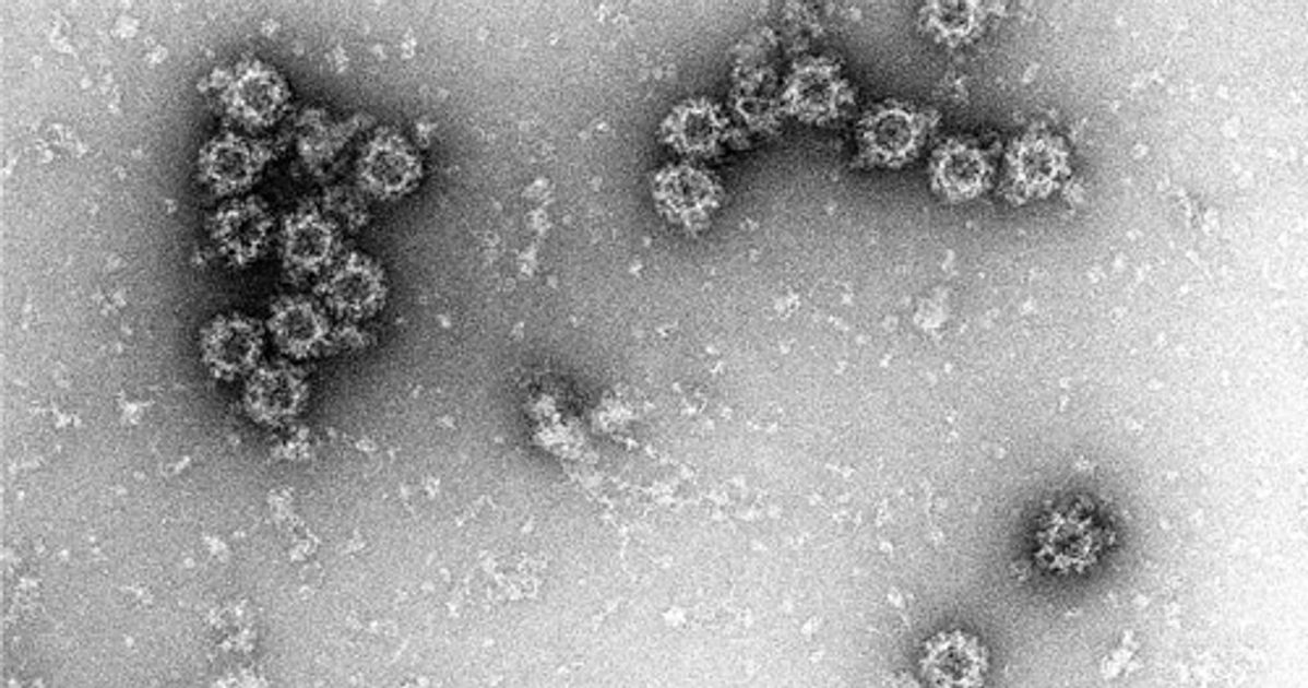 Norovirus-Like Particles | SelectScience