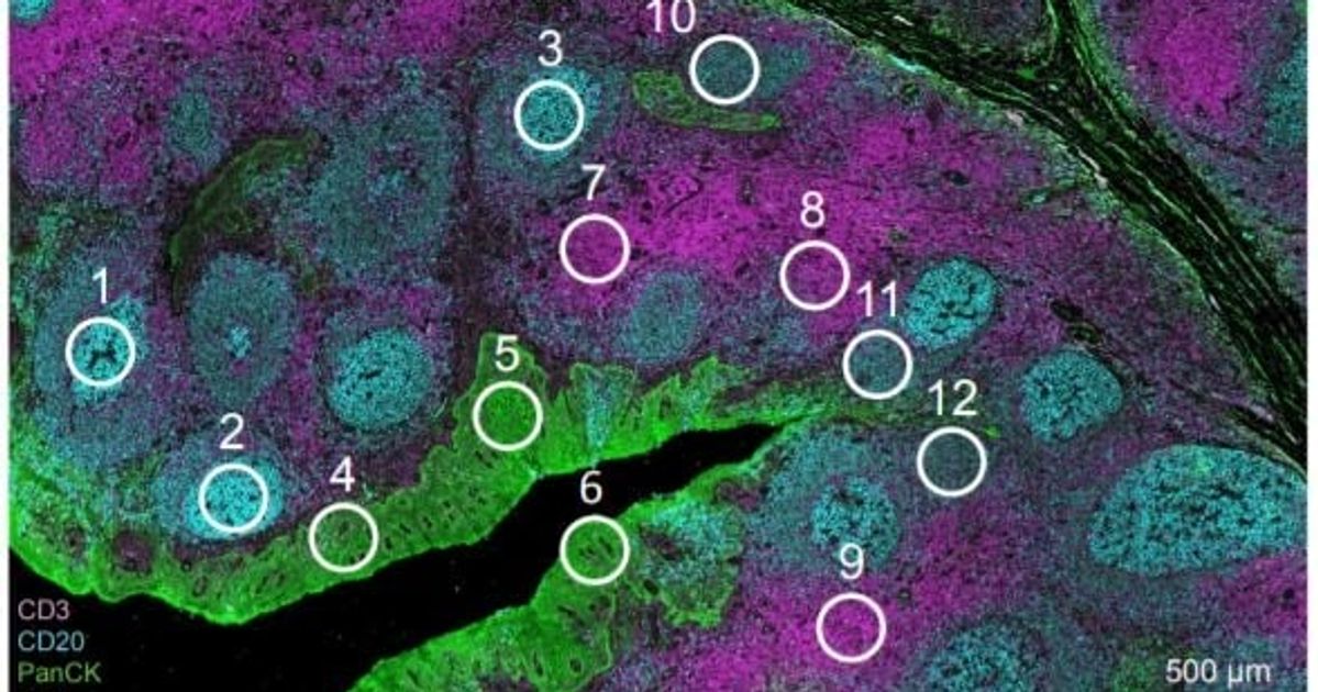 GeoMx Digital Spatial Profiler | SelectScience