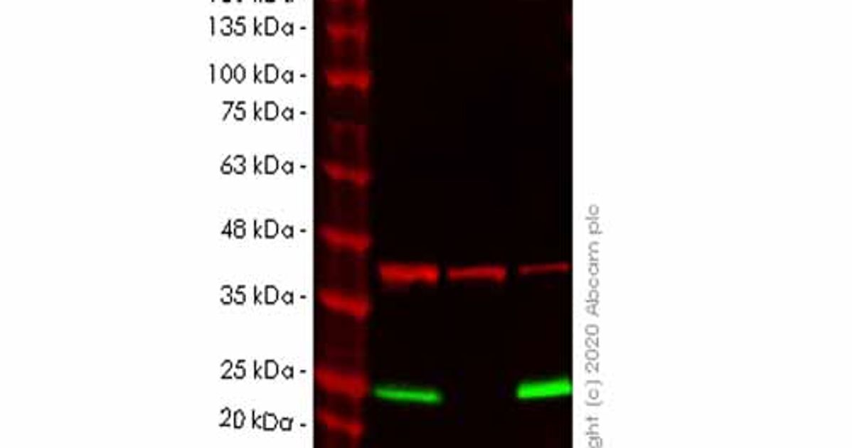 Human PERP knockout HeLa cell line | SelectScience