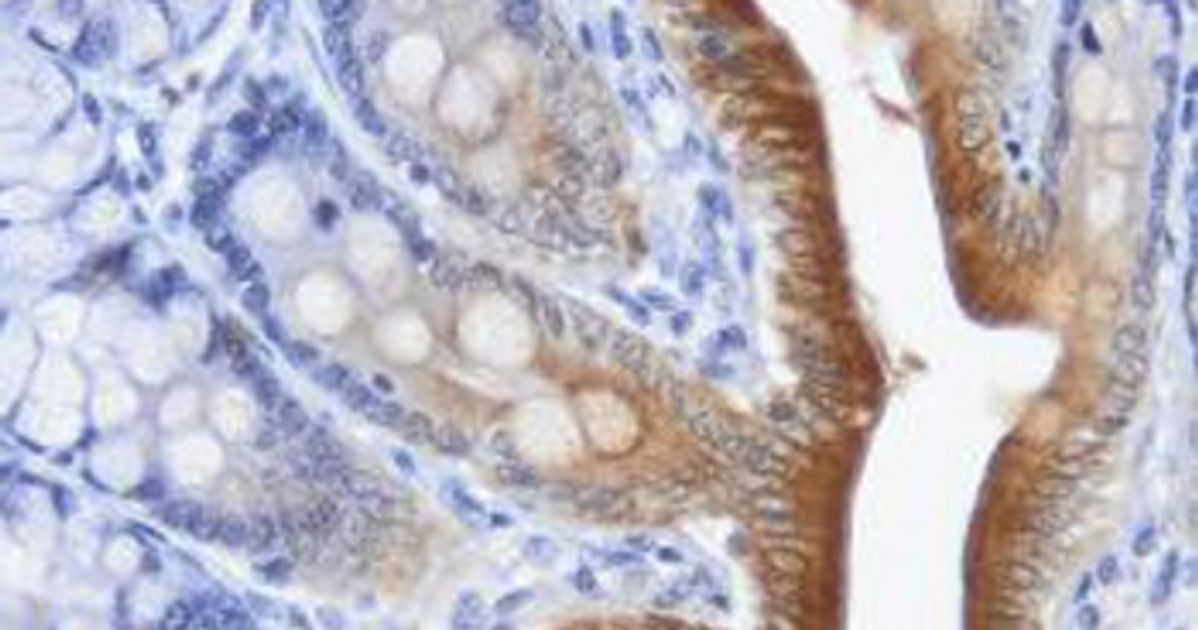 Generate robust and reliable immunohistochemistry data with PROGEN ...