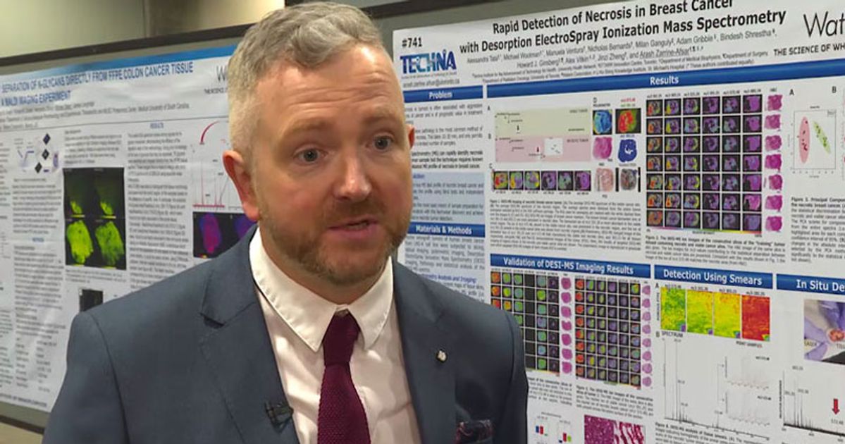 Identifying Necrosis in Breast Cancer Using Electrospray Ionization ...