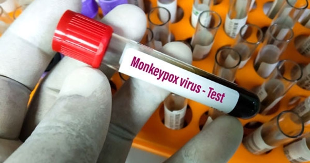 Custom Primers & Probes | SelectScience