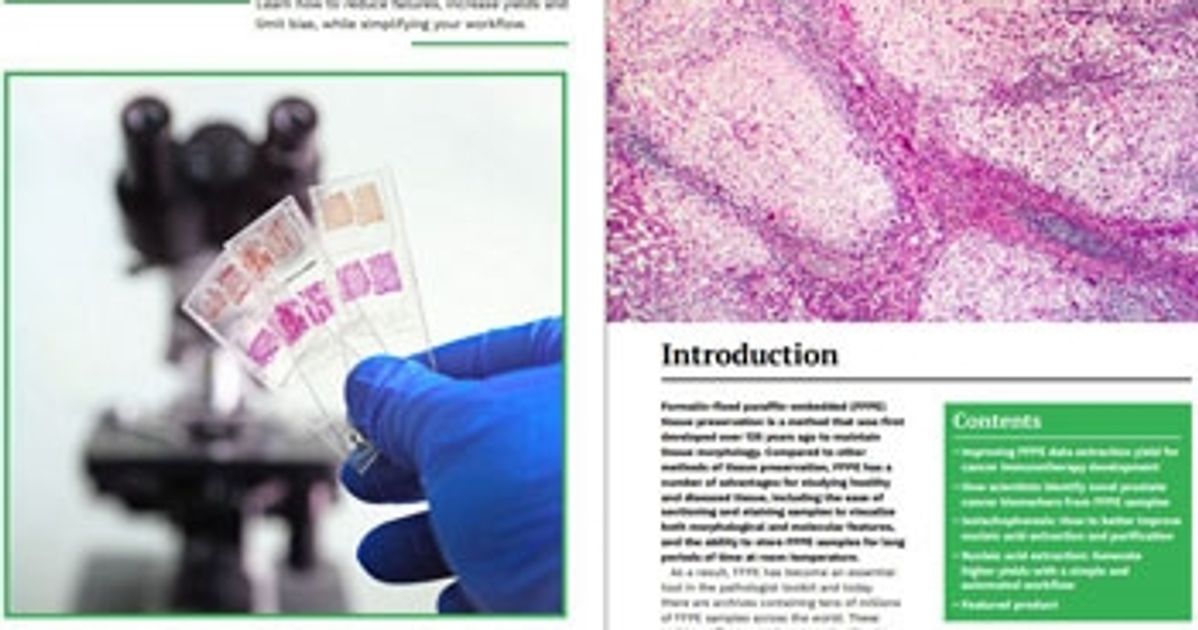 Take your FFPE DNA and RNA extraction to the next level