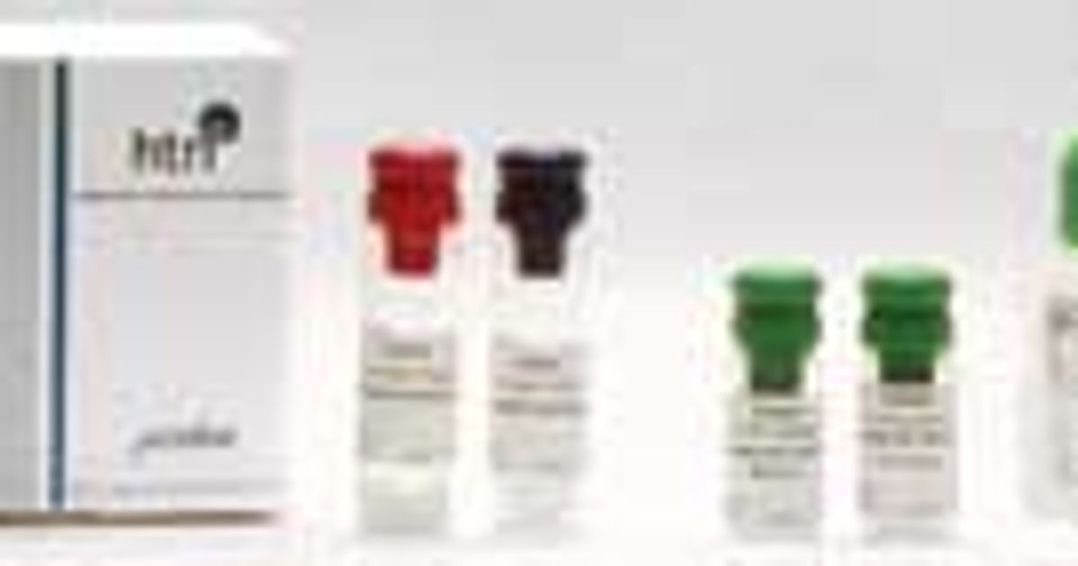 Cortisol assay kit reviews