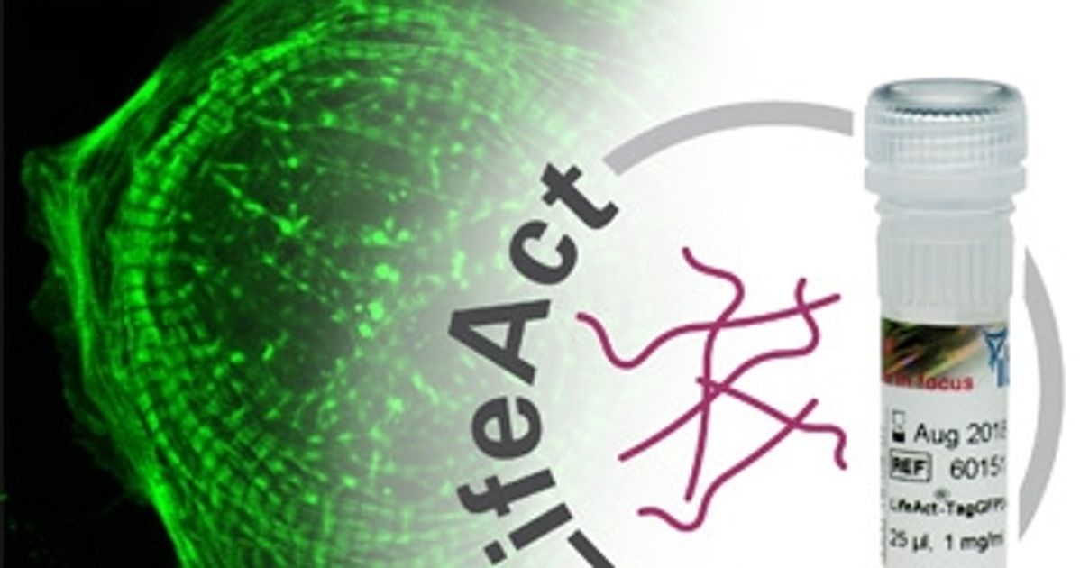 A Ready-to-Use, LifeAct-Encoding mRNA for Rapid and Non-Toxic F-Actin ...