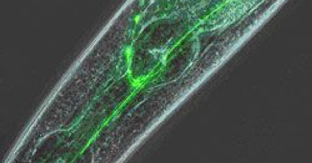 Generating superior phase contrast images without phase contrast ...