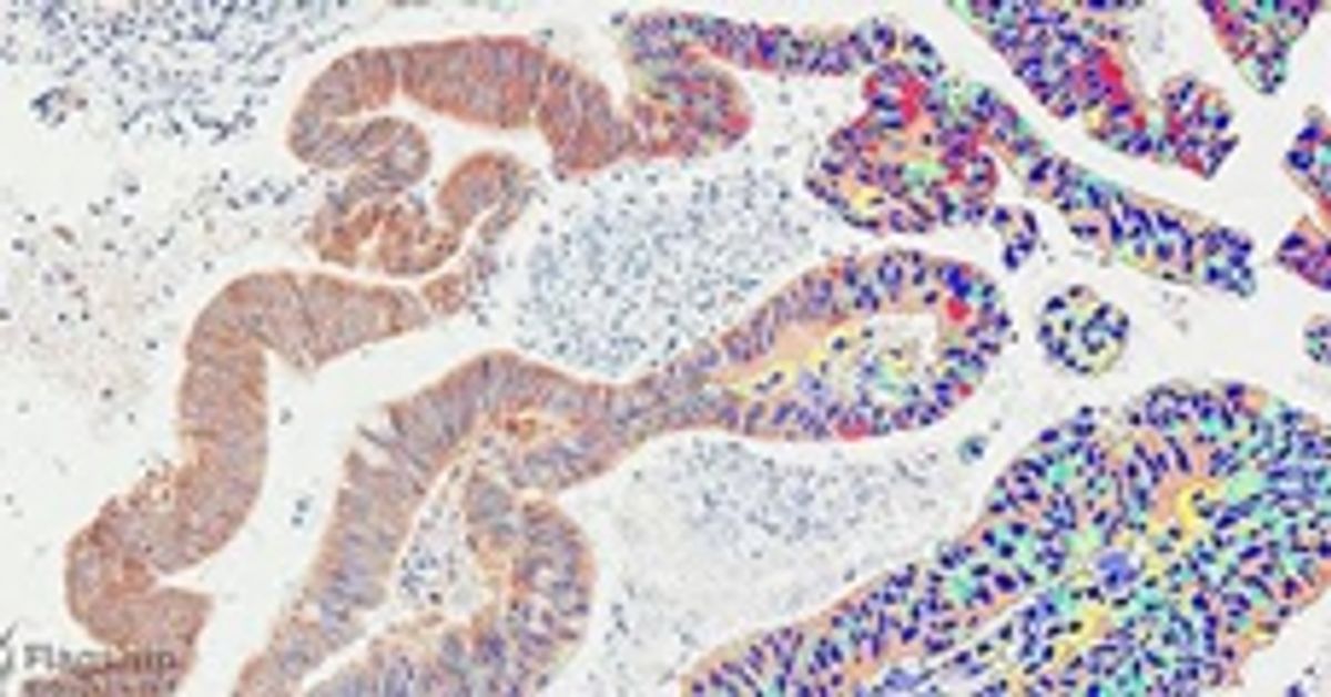 Datacolor and Flagship Biosciences to Integrate CHROMACAL Color ...