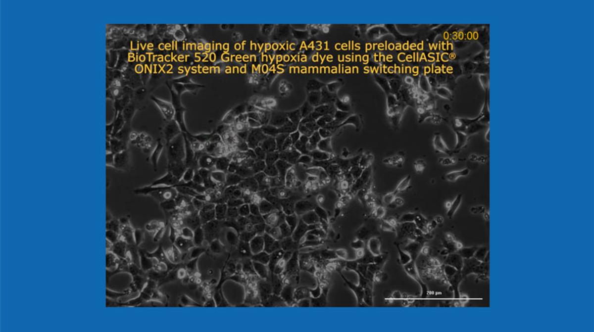 Live Cell Imaging of Hypoxia in Cancer Cells using the CellASIC® ONIX2 ...