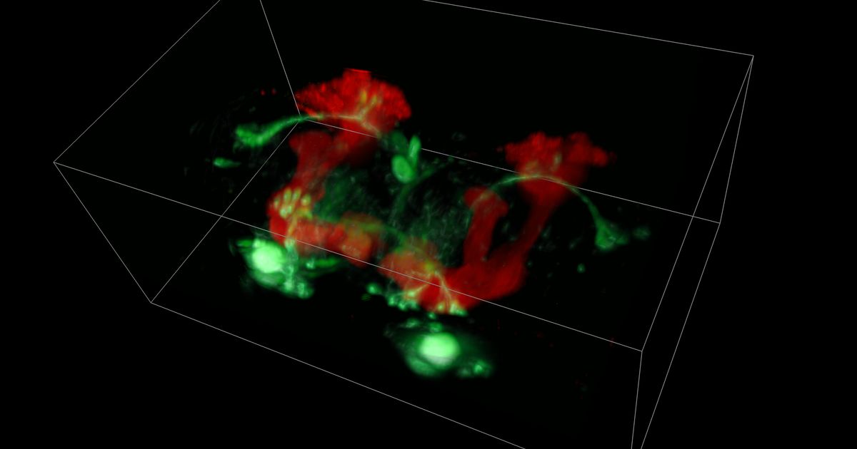 Development of SCAPE Microscopy – Real-Time 3D Imaging of Living Organisms
