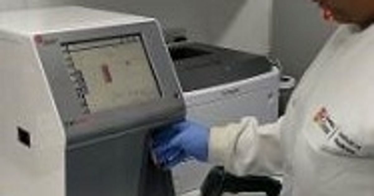 UK’s First DxH 500 Compact Hematology Analyzer Installed at the ...