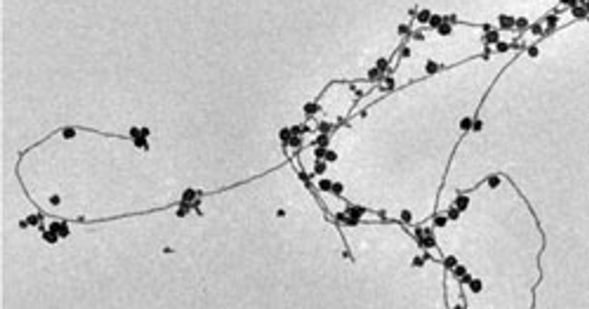 Stanford Scientists Create Gold Nanoparticles in Water