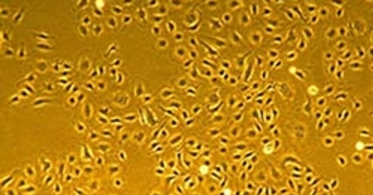 Buy Normal -(HUVEC) Human Umbilical Vein Endothelial Cells Read Reviews