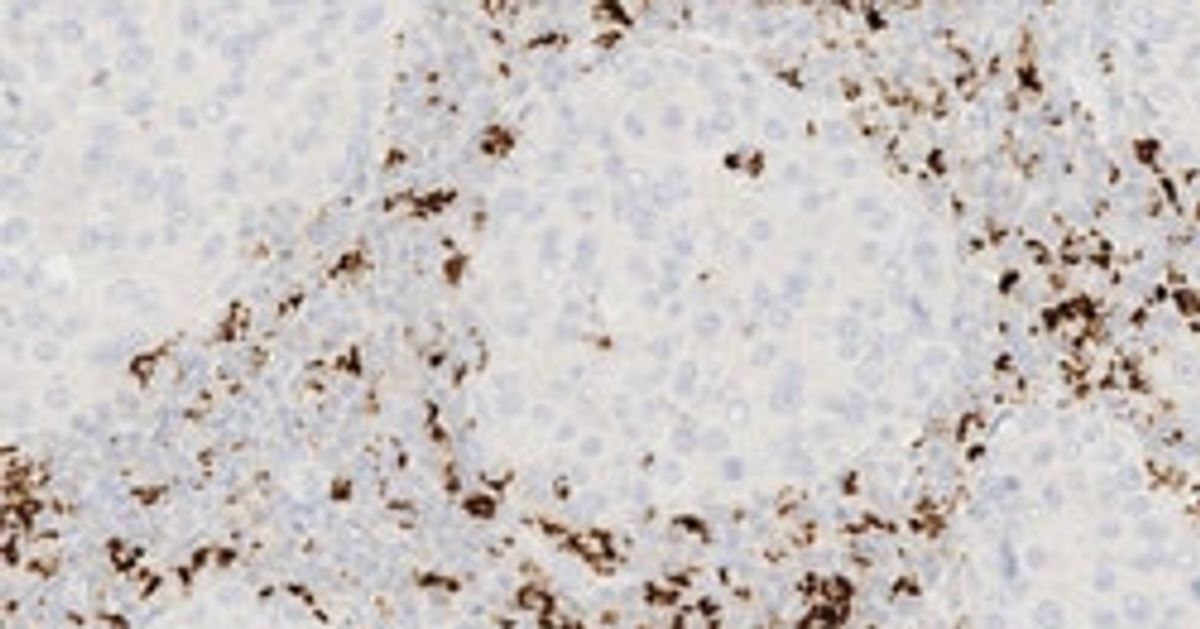 VENTANA PD-L1 (SP142) Assay (CE IVD) reviews