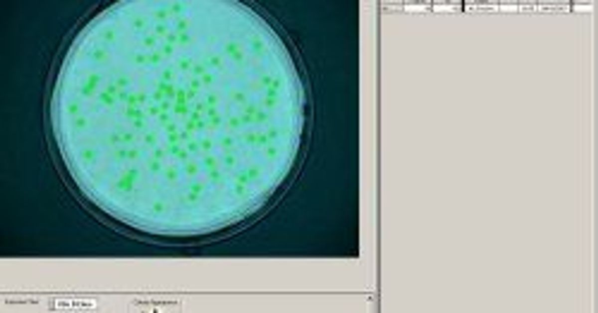New Microbiology Imaging Software Offers Fast, Accurate Analysis of ...