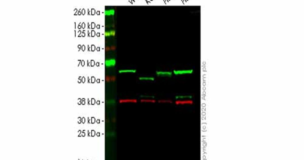Human SQSTM1 (p62) knockout HCT116 cell line | SelectScience