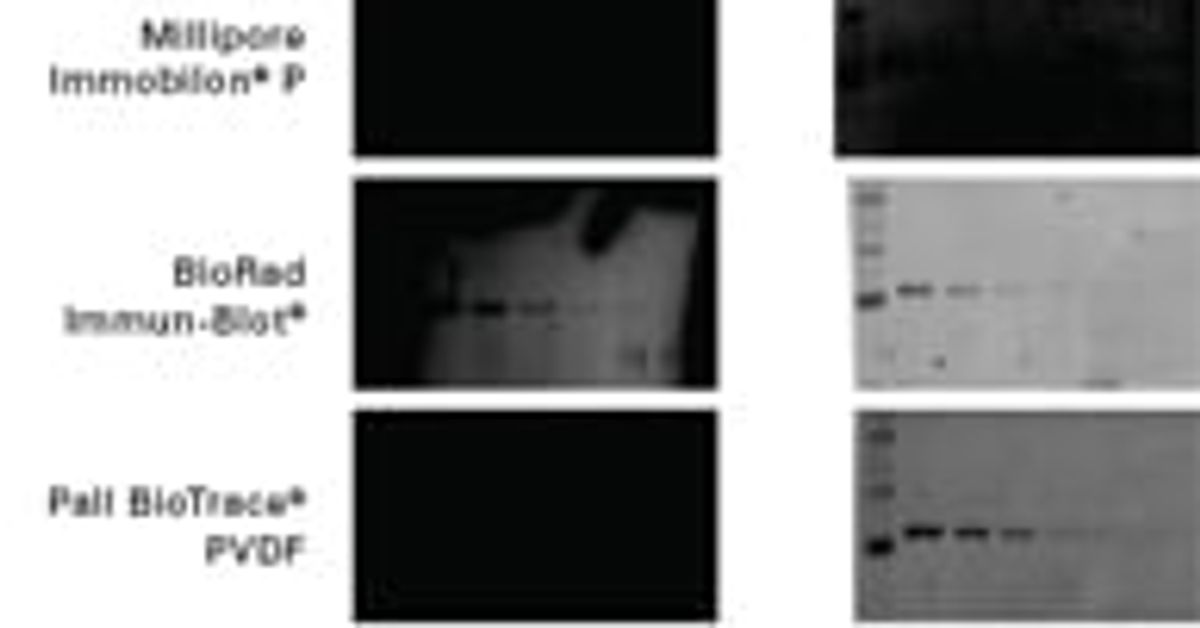 Western Blot Membranes and Membrane Kits