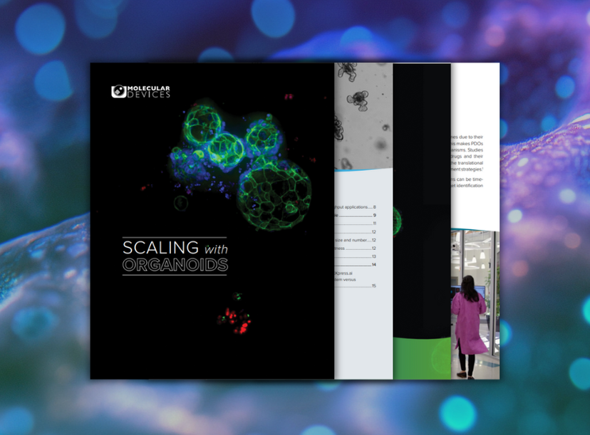 The latest breakthroughs on organoid development and analysis