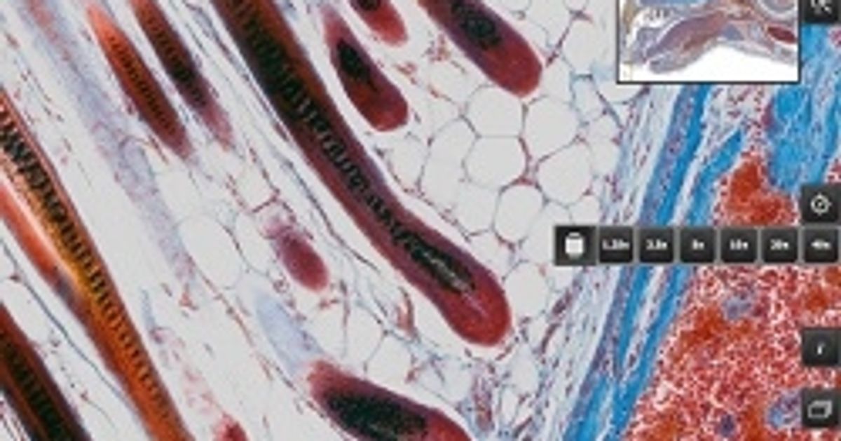 Olympus Releases Free Virtual Microscope Image App for the Ipad.