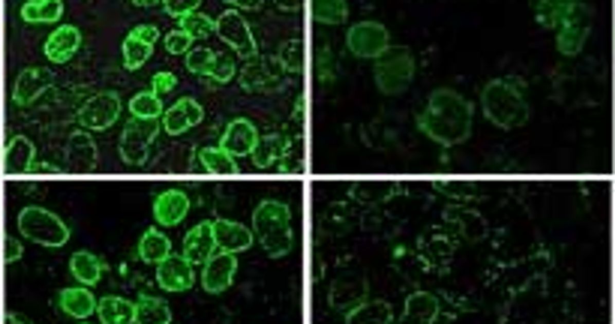 jetPEI™ the powerful transfection reagent