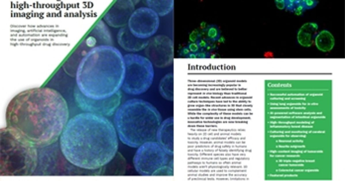 Organoids: Overcome the challenges of high-throughput 3D imaging and ...