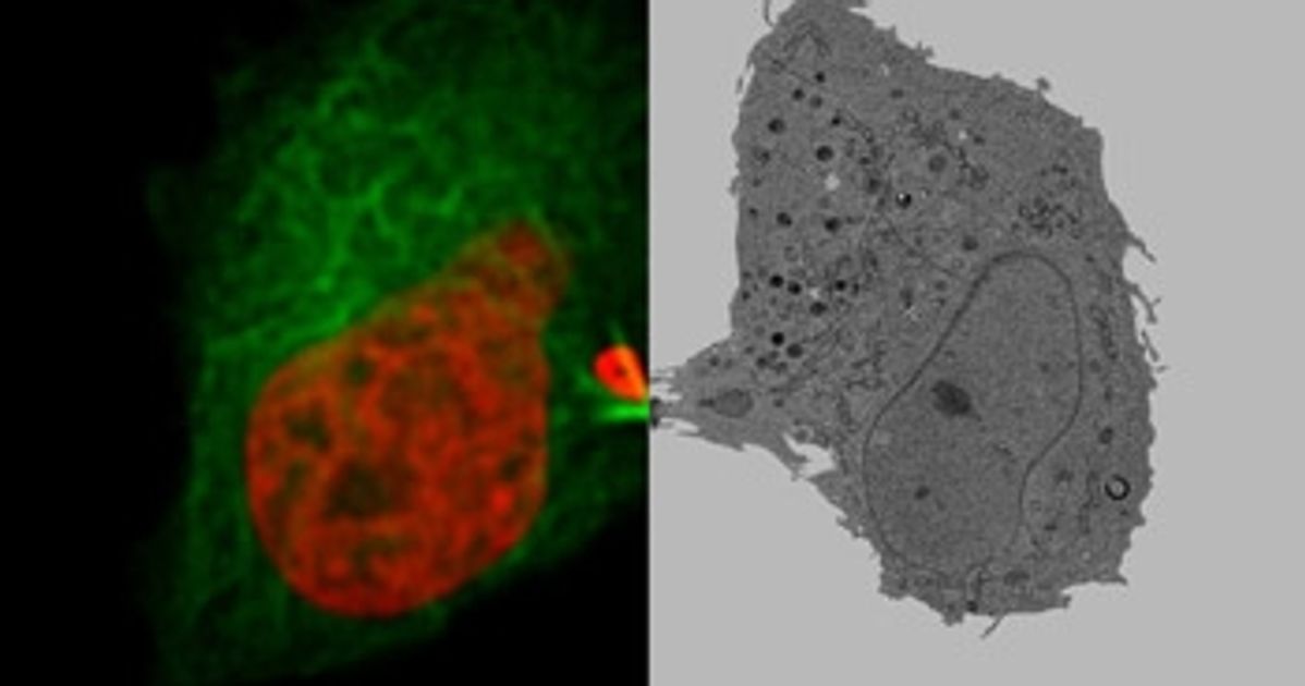Leica Microsystems launches ground-breaking Live-Cell CLEM workflow