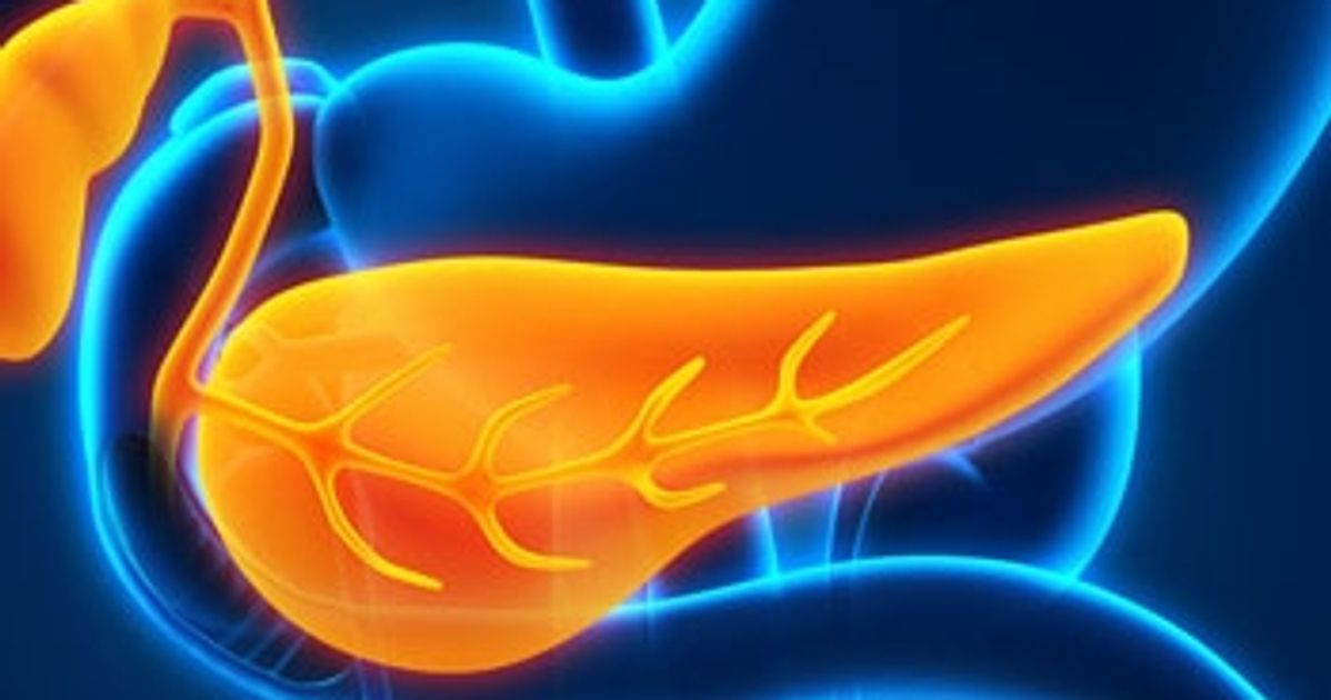 Identify Biomarkers for Earlier Diagnosis of Pancreatic Cancer