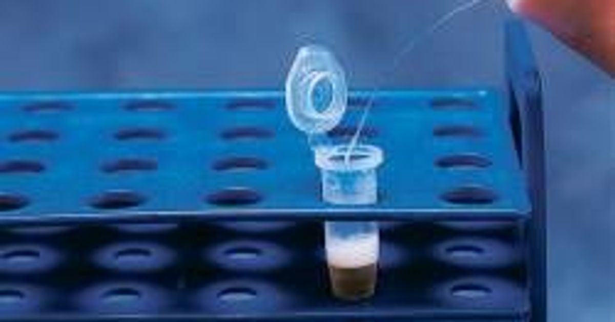 Microprobes for Temperature Measurement