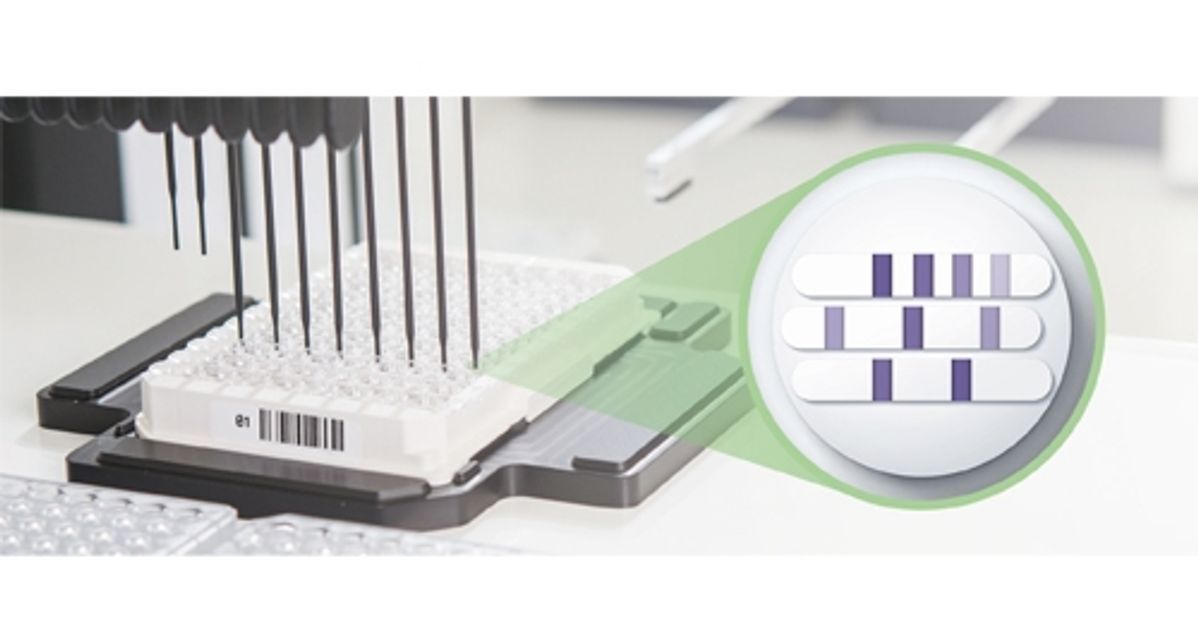 Lyme Disease Diagnostic Tests | SelectScience