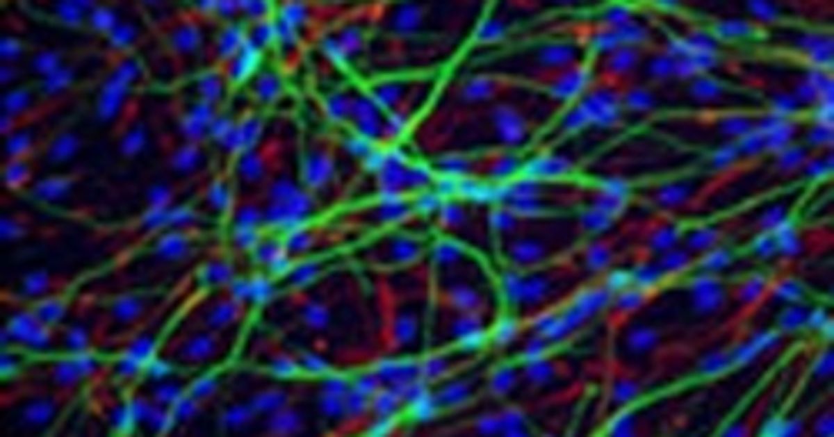 Buy CRISPR Edited iPS Cell Lines Read Reviews