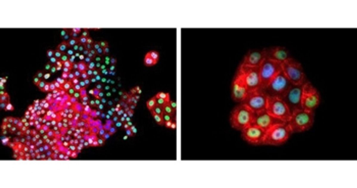 Patient-derived human primary cancer cells