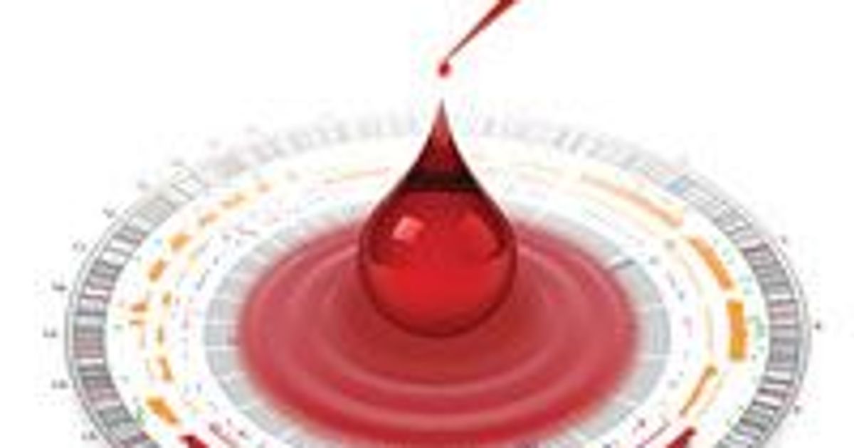 Epicentre’s New Globin-Zero™ Gold Kit Distributed Exclusively in the UK ...