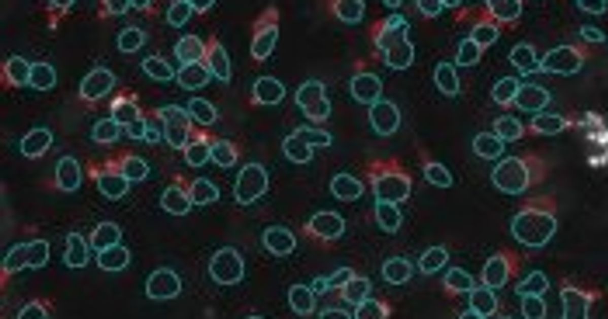 Cytotoxicity V2 Image Analysis BioApplication