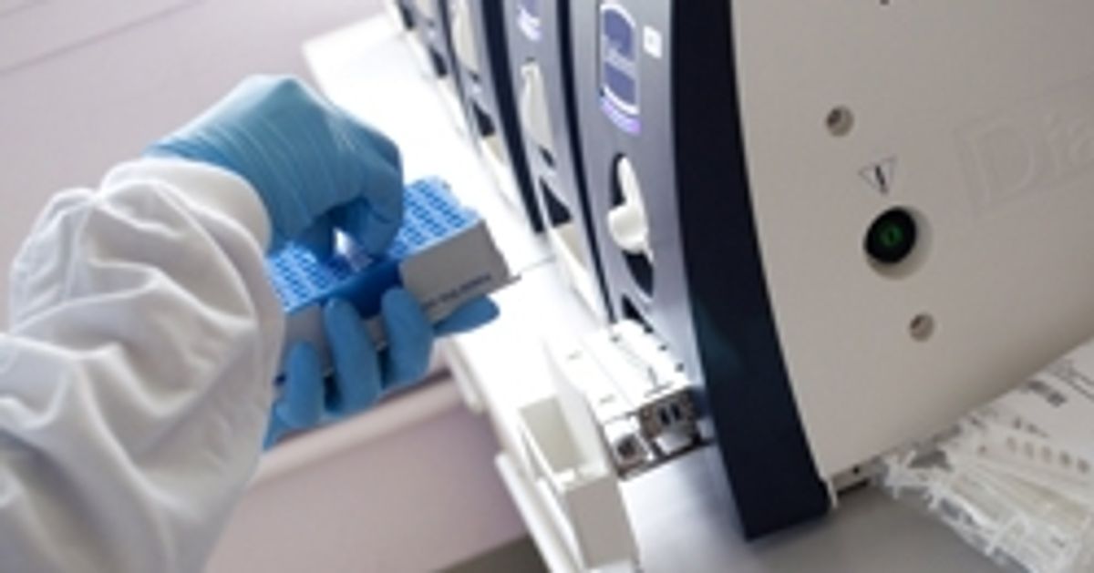 New Iam CMV Provides Speed and Accuracy for the Diagnosis and ...