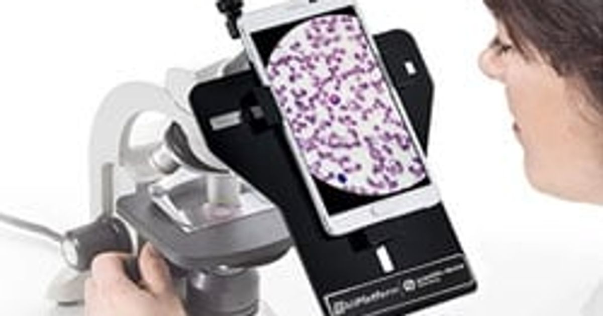 MiPlatform Smartphone Microscope Adapter reviews