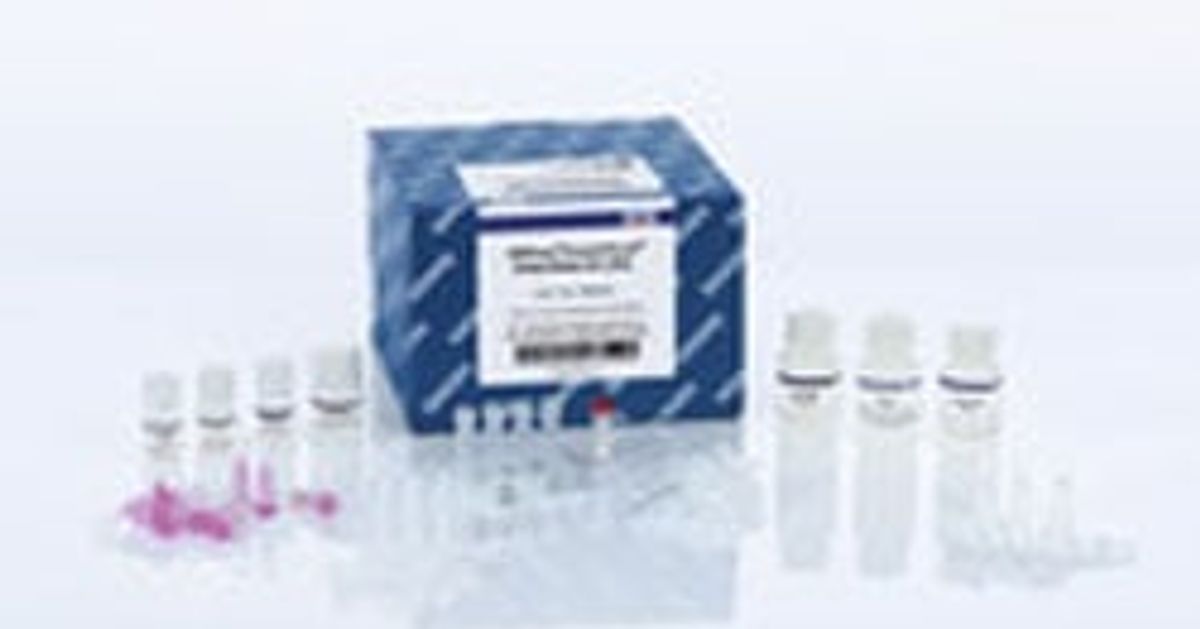 AllPrep PowerFecal DNA/RNA Kit reviews