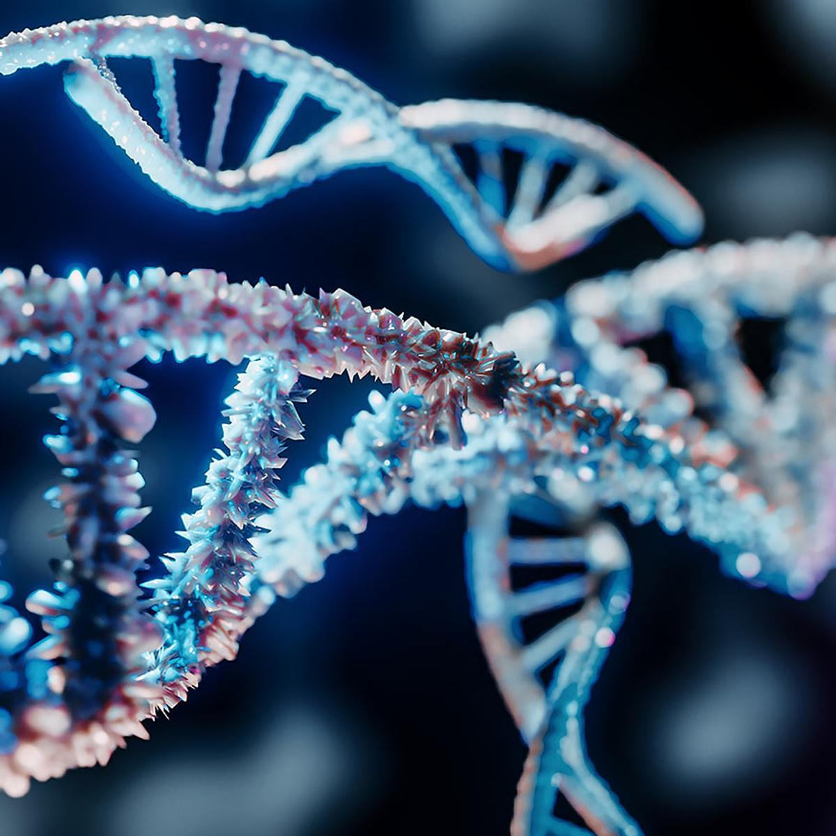 VITROS® 250/350 Chemistry System