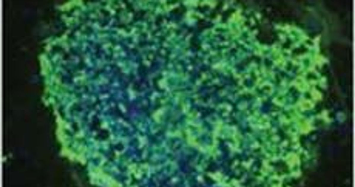 Geltrex™ Reduced Growth Factor Basement Membrane Matrix reviews