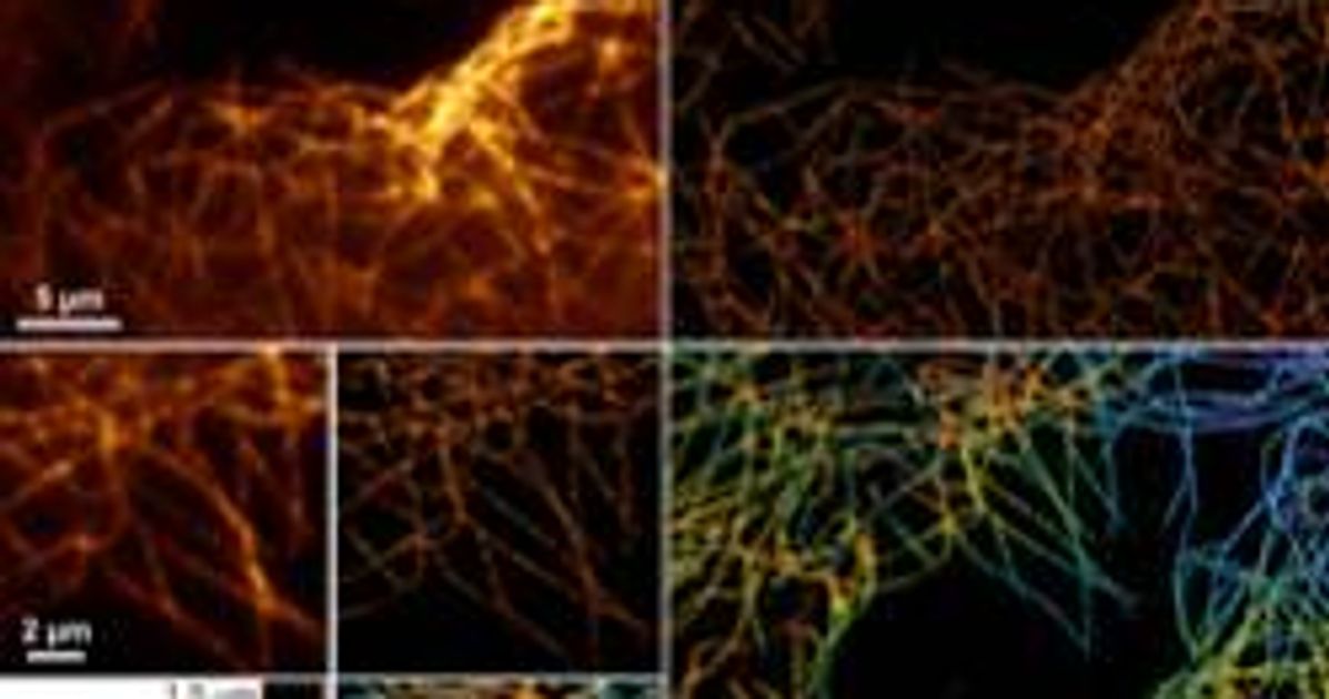 Molecular Devices Introduces Real-Time Super-Resolution System for ...